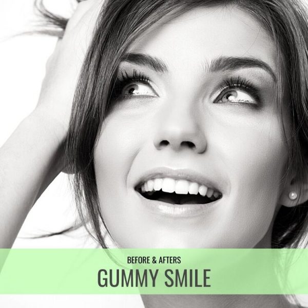 Magnolia Medical Aesthetics Medical Aesthetics Botox Dermal Fillers