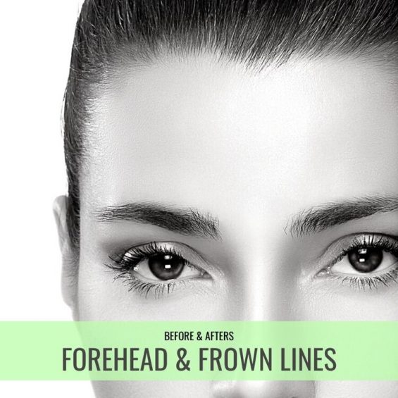 Magnolia Medical Aesthetics Medical Aesthetics Botox Dermal Fillers