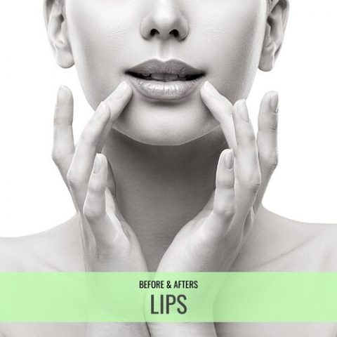 Magnolia Medical Aesthetics – Medical Aesthetics, Botox, Dermal Fillers ...